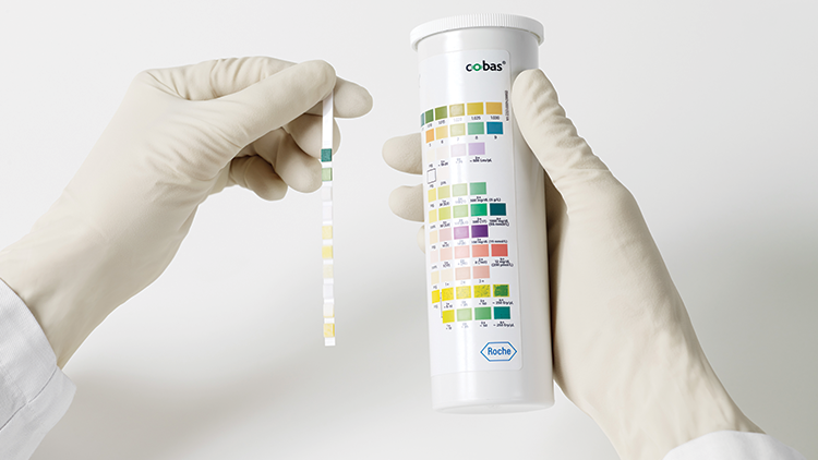Combur Urine Reagent Test Strips – HMGDirect