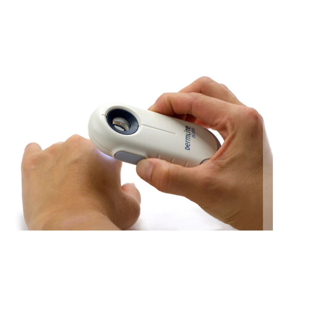 DermLite DL100 Hand Held Pocket Dermatoscope – HMGDirect