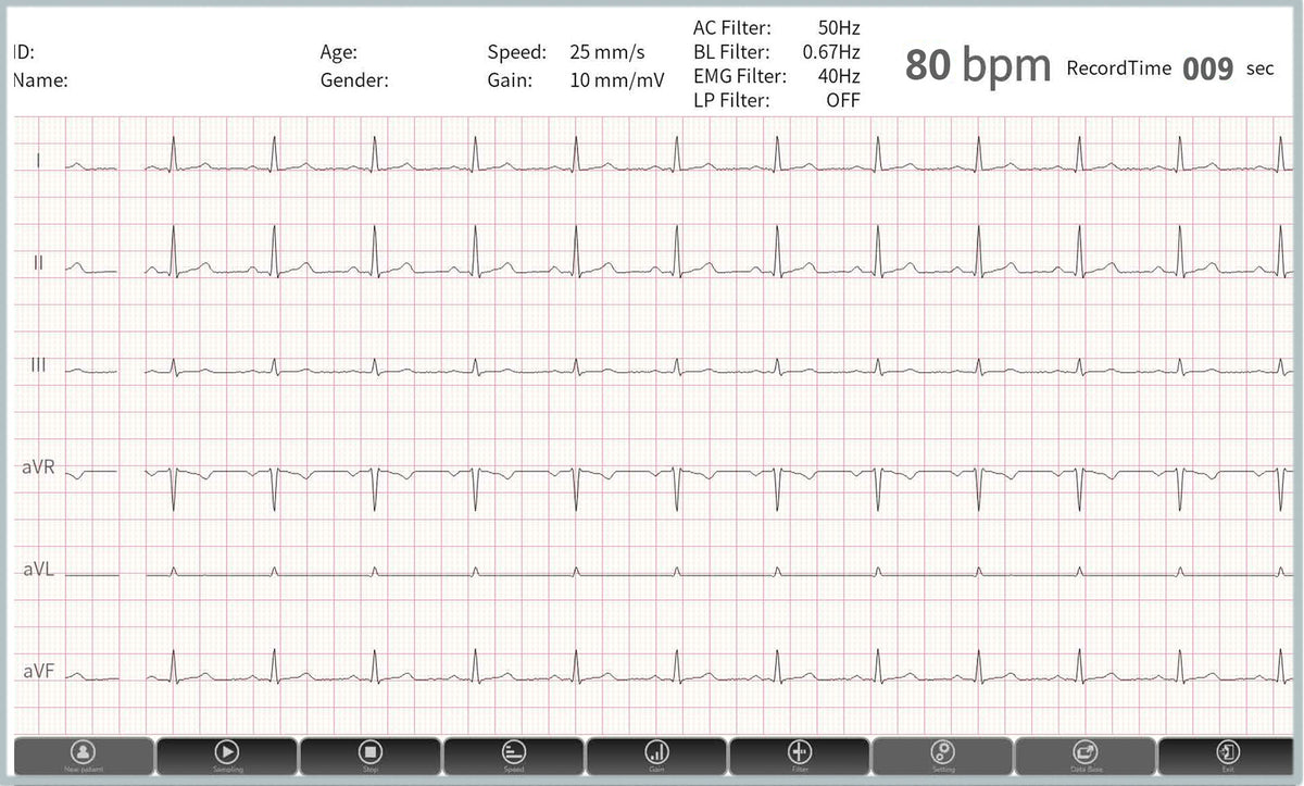 ECGMAC PE-1202 PC Based ECG Machine With Software & Bluetooth – HMGDirect