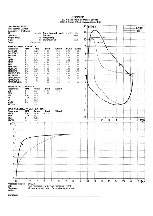 COSMED Pony FX Desktop Spirometer With Inbuilt Printer & Software ...