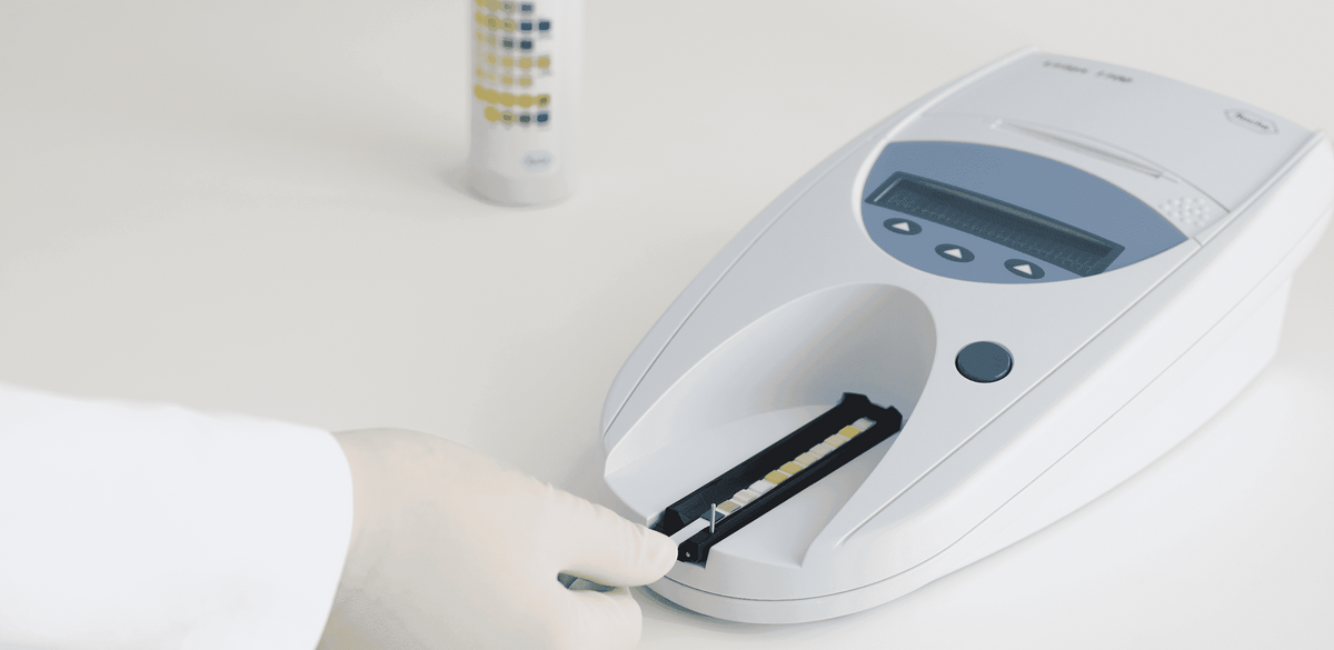 Urisys 1100 Urine Diagnostic Analyser – HMGDirect
