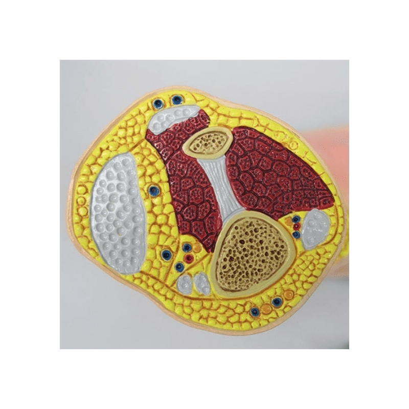 Foot Gout Anatomical Model | HMGDIRECT Australia – HMGDirect
