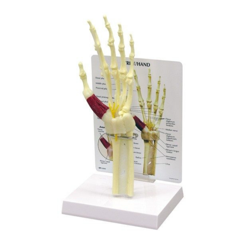Hand & Wrist Carpal Tunnel Life Size Anatomical Model | HMGDIRECT ...