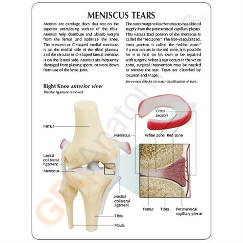 Knee Meniscus Tears Anatomical Model | HMGDIRECT Australia – HMGDirect